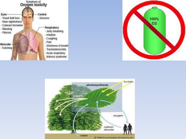 Oxygen toxicity project | PPTX
