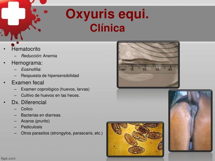 Oxyuris Equi Sintomas