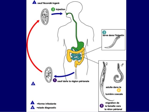 Oxyurose ascaridiose - trichocephalose