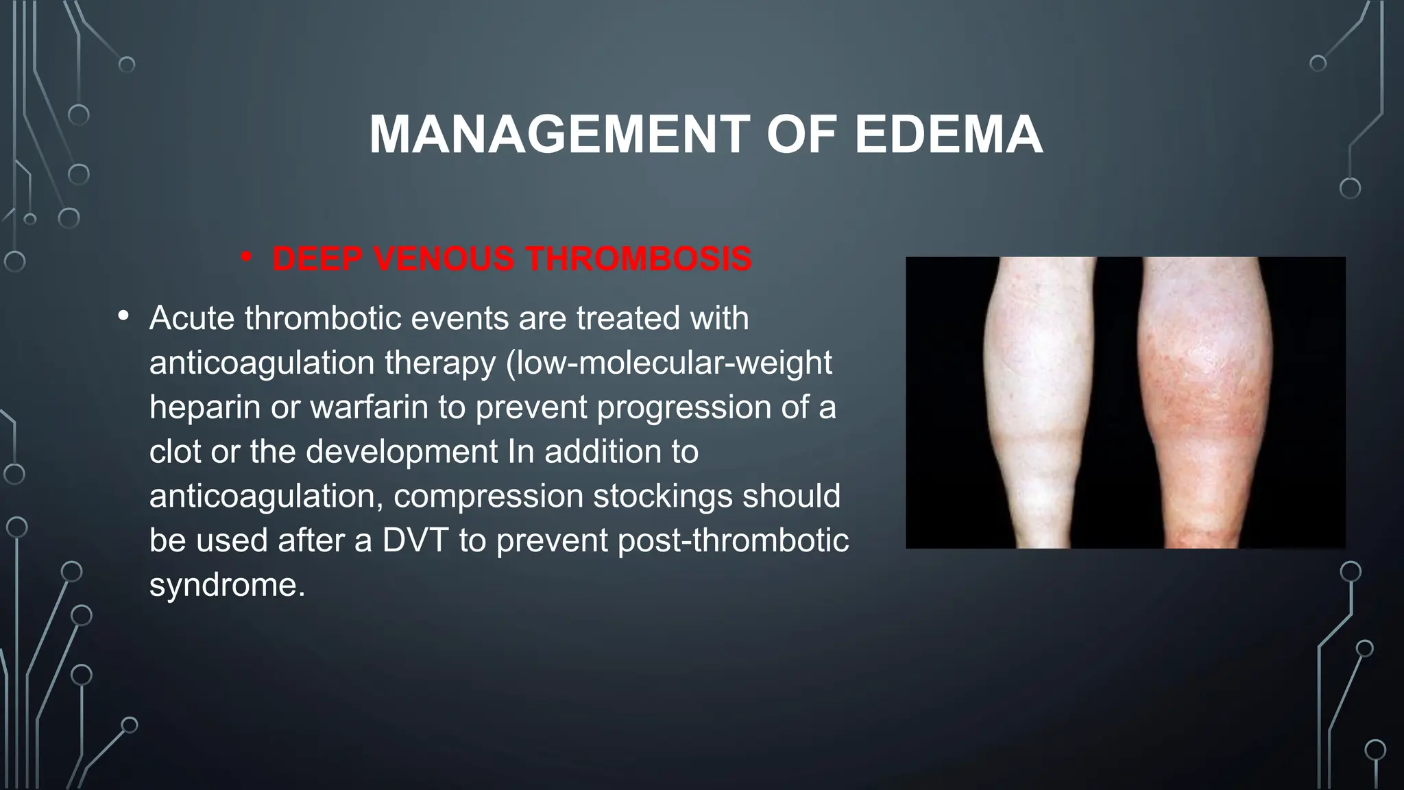 Edema and it's types ( presentation ) medicine | PDF
