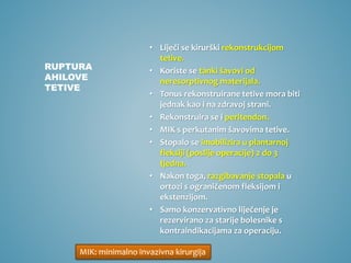 Ozljede mišića i tetiva | PPSX