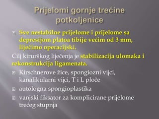 Ozljede potkoljenice i gležnja | PPSX