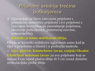 Ozljede potkoljenice i gležnja | PPSX