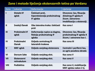 Ozljede tetiva na rukama | PPSX