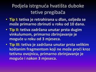 Ozljede tetiva na rukama | PPSX