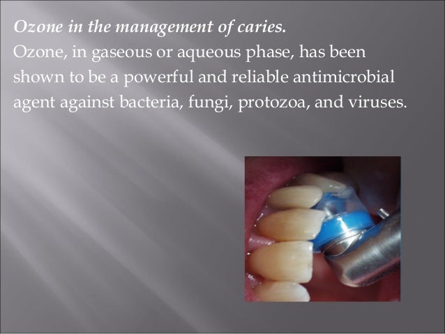 Ozone application in operative dentistry