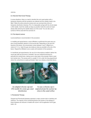 Ozone therapy in the dentistry | DOCX