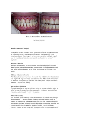 Ozone therapy in the dentistry | DOCX