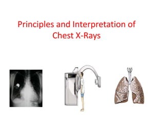 basic_chest_x_ray_.ppt