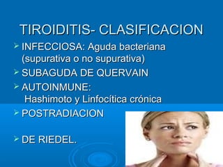 P. de funcion tiroidea y tiroiditis | PPT