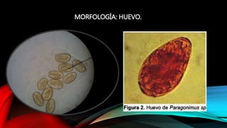 Paragonimus Mexicanus Pptx
