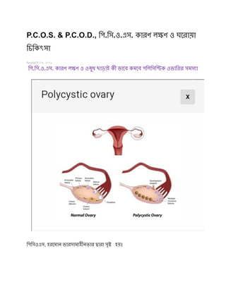 P.C.O.S Treatment.pdf