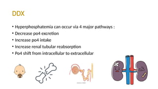 Phosphorus disturbance | hyperphosphatemia | hypophosphatemia | PPT