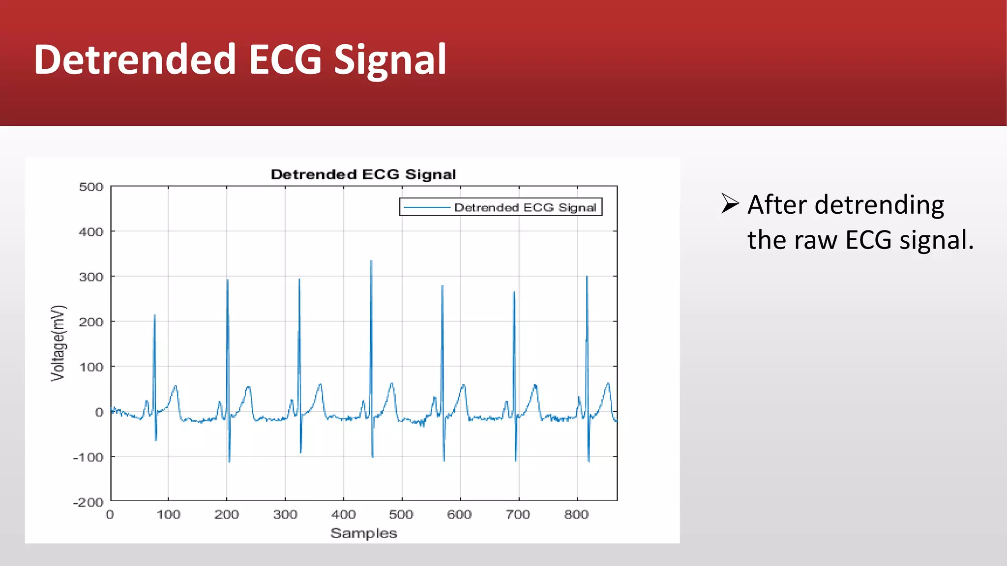 P-QRS-T peak detection of ECG signal by MATLAB | PPTX