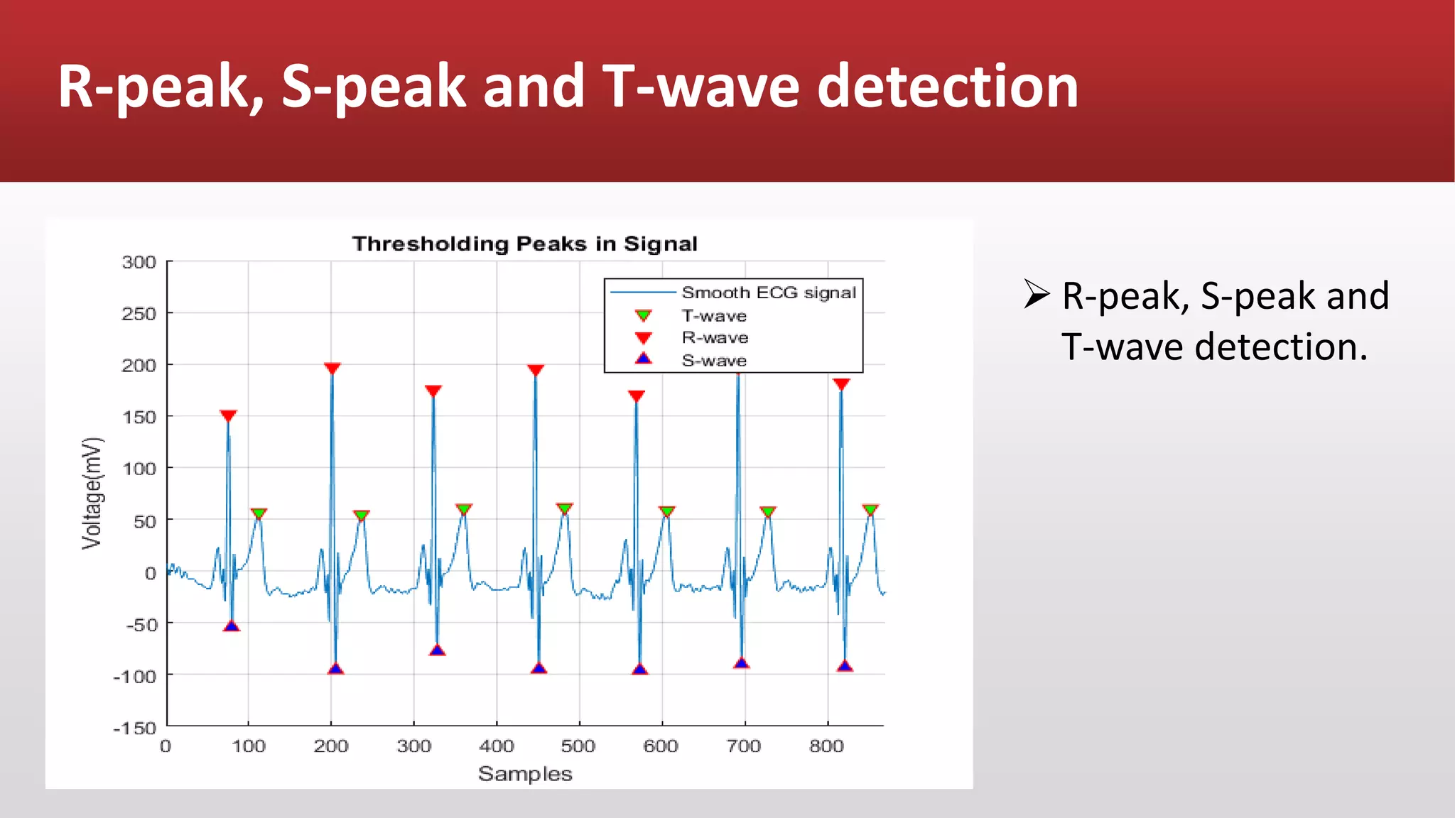 P-QRS-T peak detection of ECG signal by MATLAB | PPTX