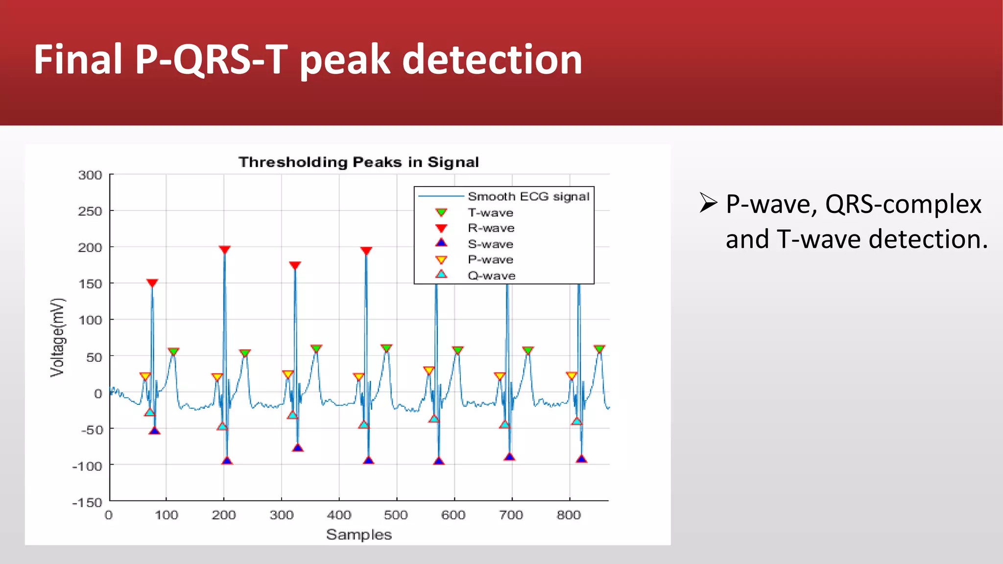 P-QRS-T peak detection of ECG signal by MATLAB | PPTX