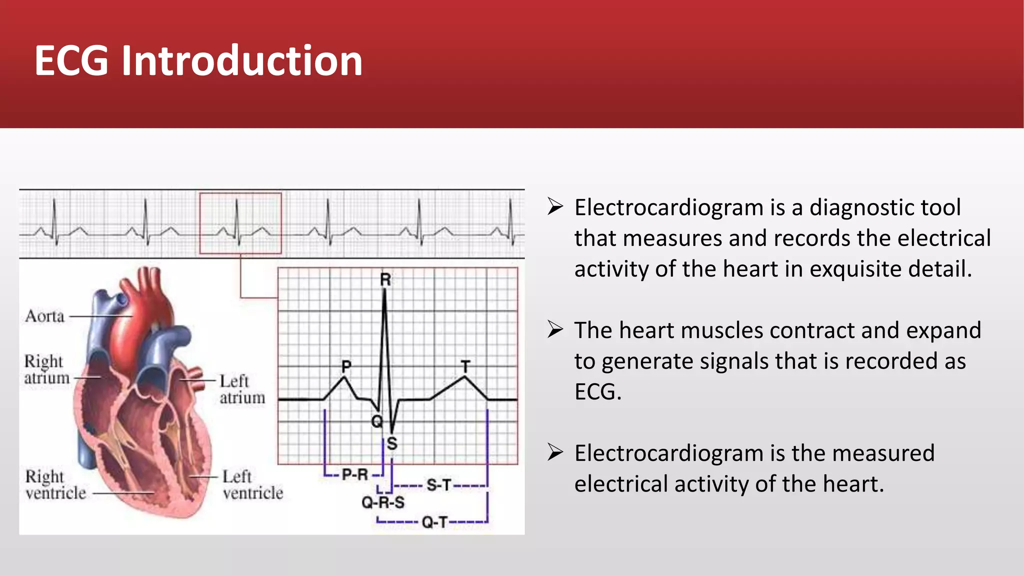 P Qrs T Peak Detection Of Ecg Signal By Matlab Pptx Heart And Cardiovascular Diseases