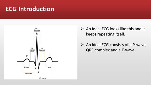 P-QRS-T peak detection of ECG signal by MATLAB | PPTX | Heart and Cardiovascular Diseases ...