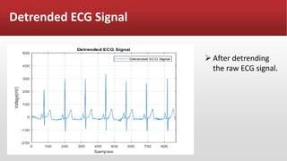 P-QRS-T peak detection of ECG signal by MATLAB | PPTX