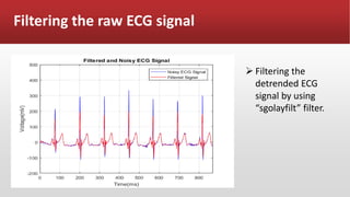 P-QRS-T peak detection of ECG signal by MATLAB | PPTX