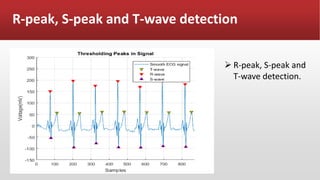 P-QRS-T peak detection of ECG signal by MATLAB | PPTX