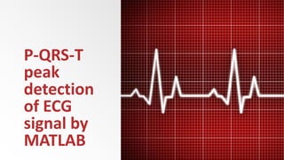 P-QRS-T peak detection of ECG signal by MATLAB | PPTX