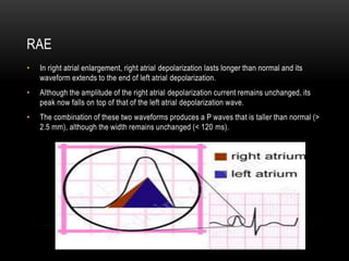 P wave axis and escape rhythms | PPTX