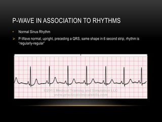 P wave axis and escape rhythms | PPTX