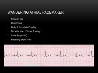 P wave axis and escape rhythms | PPTX