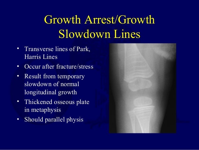 P01 ped trauma assessment