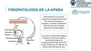 Apnea Neonatal | PPTX