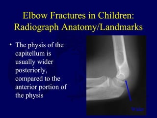 P05 pediatric elbow | PPT