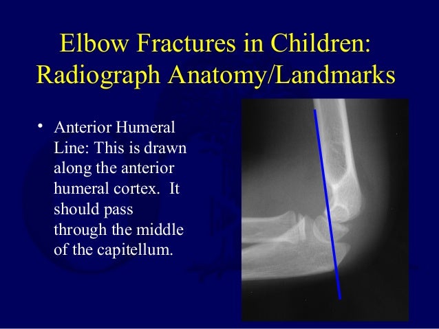 P05 pediatric elbow