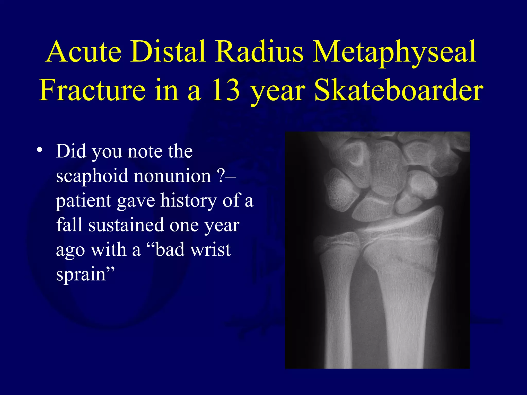 P06 pediatric forearm, hand | PPT
