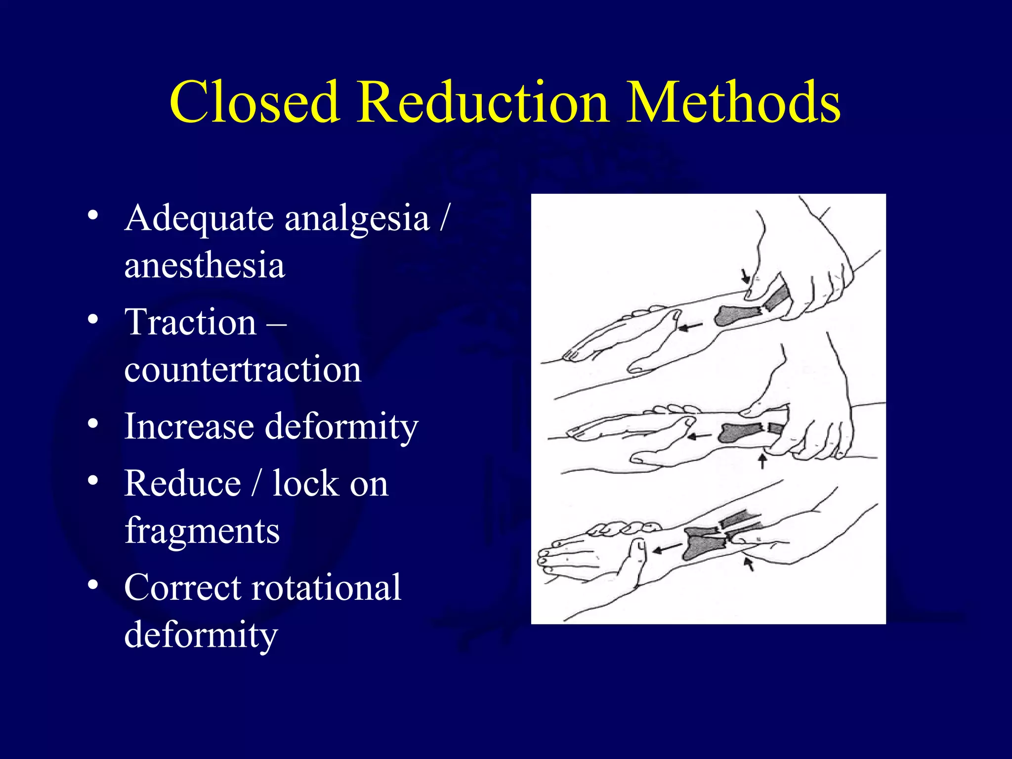 P06 pediatric forearm, hand | PPT