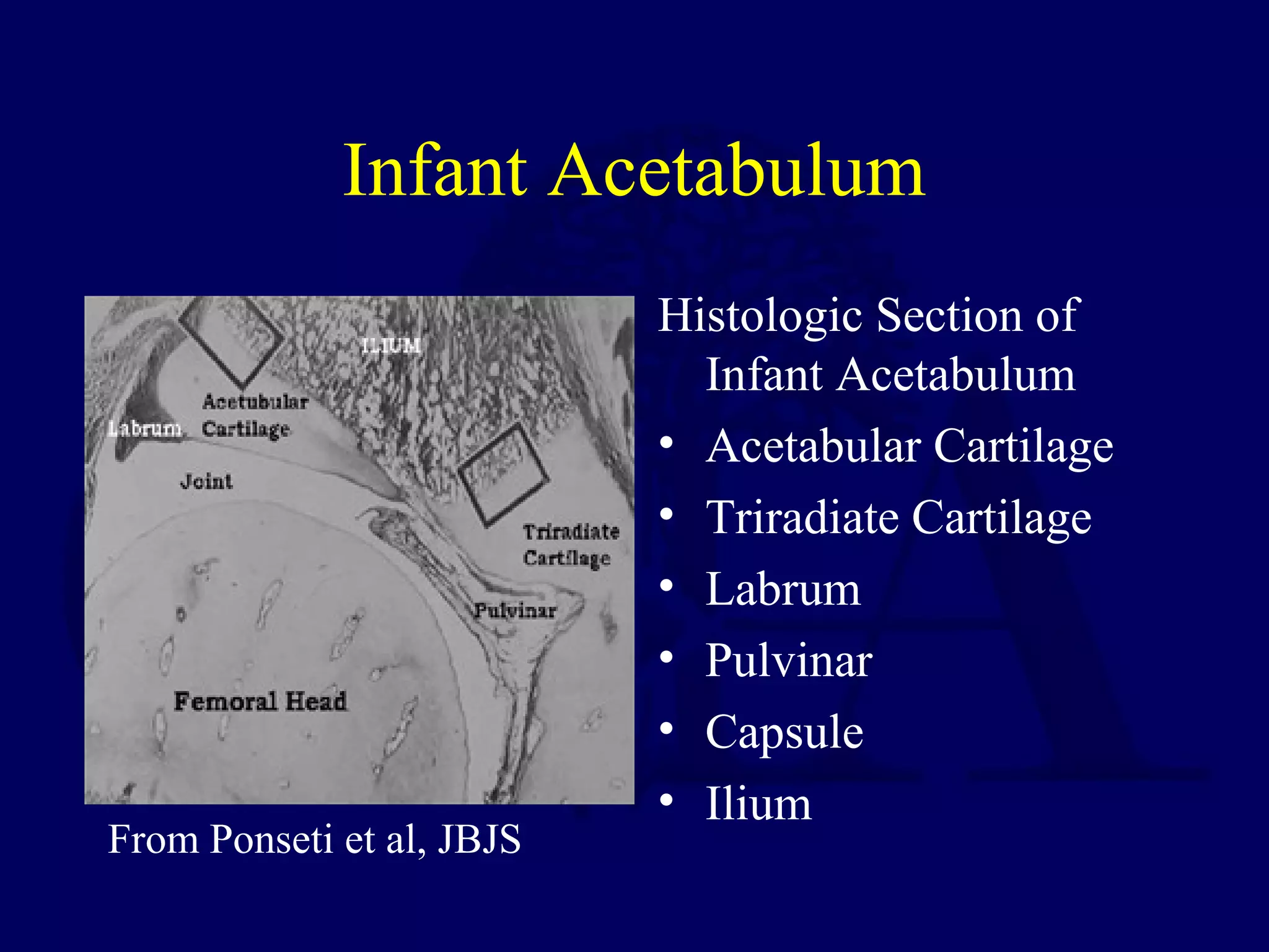 P07 pediatric pelvis, aceta | PPT