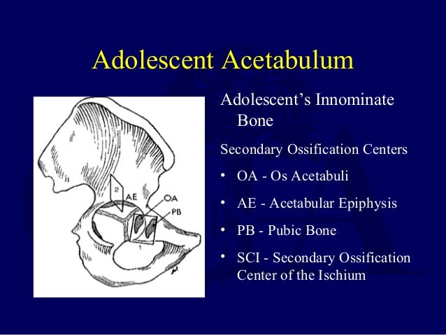 P07 pediatric pelvis, aceta