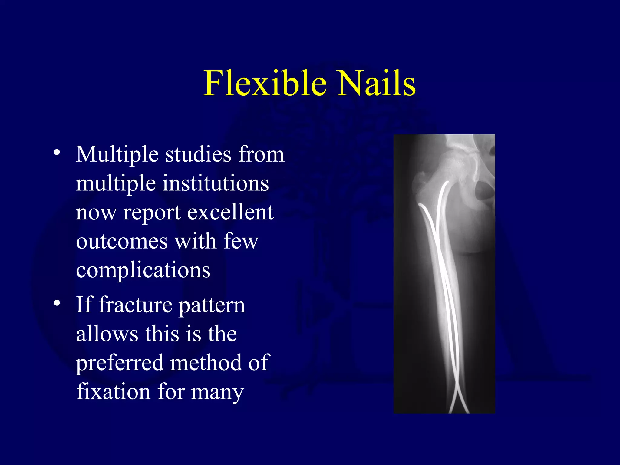P09 pediatric femur | PPT