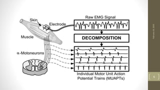Prosthetic hand control by EMG Signals.pptx