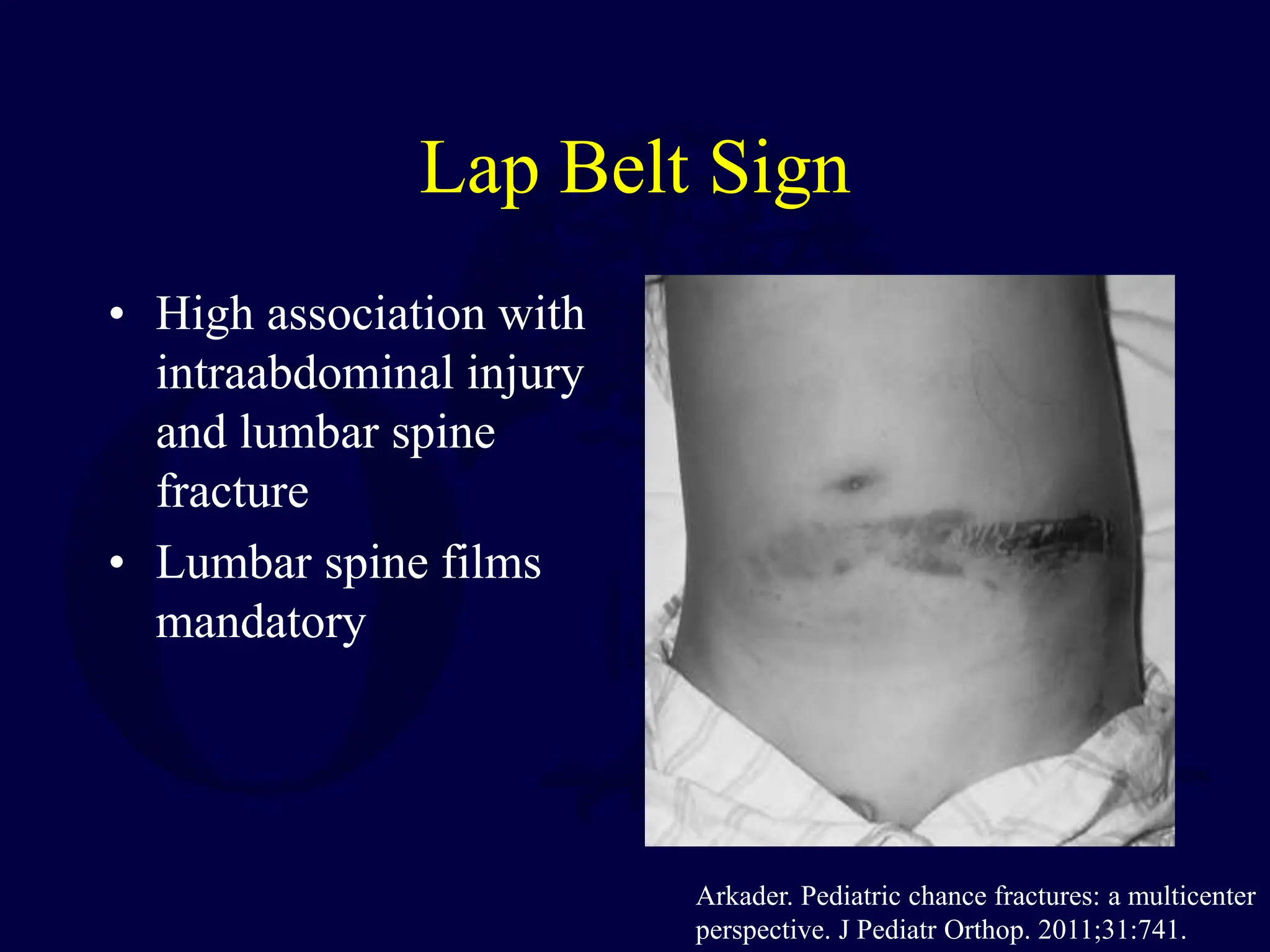 the Pediatric Spine fractures lecture.ppt