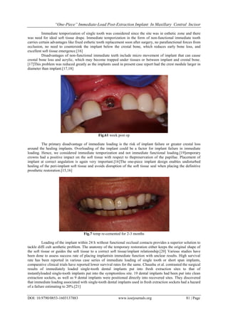 “One-Piece” Immediate-Load Post-Extraction Implant In Maxillary Central Incisor | PDF