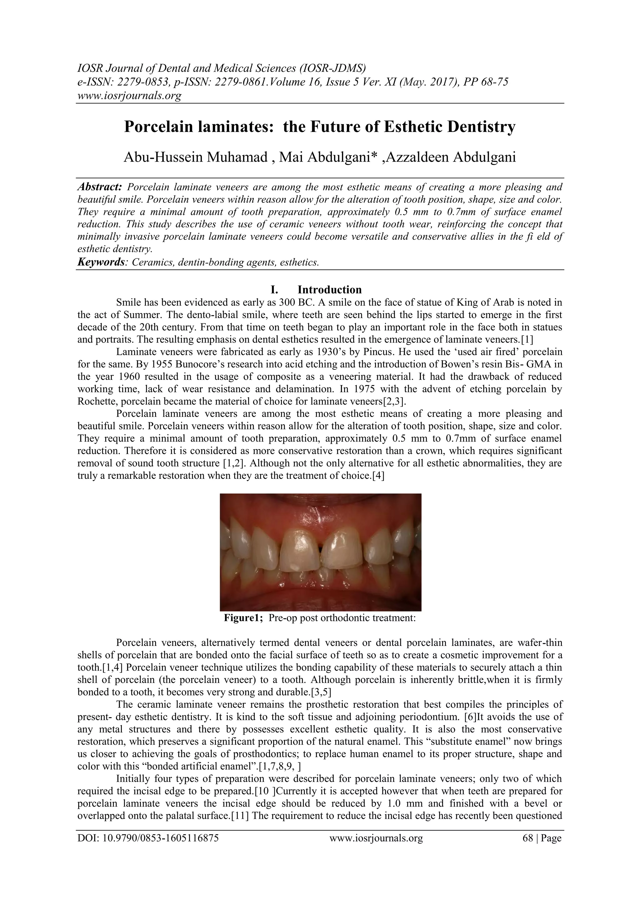 Porcelain laminates: the Future of Esthetic Dentistry | PDF