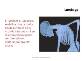 lumbago lumbagia | PPT