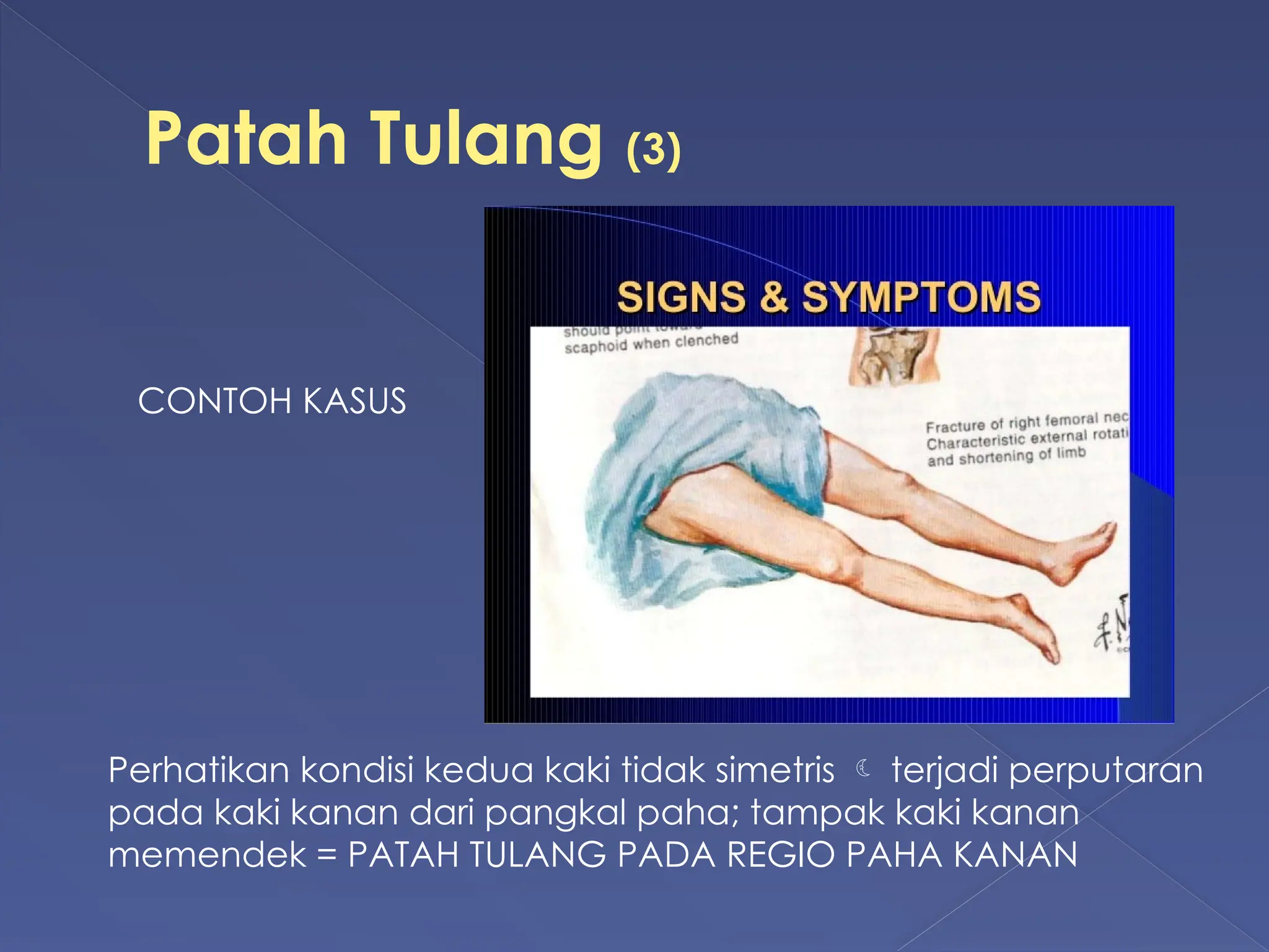 Pertolongan Pertama Pada Kecelakaan.pptx