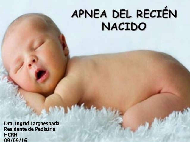 Apnea Neonatal