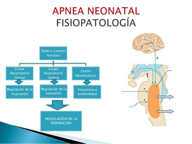Apnea Neonatal
