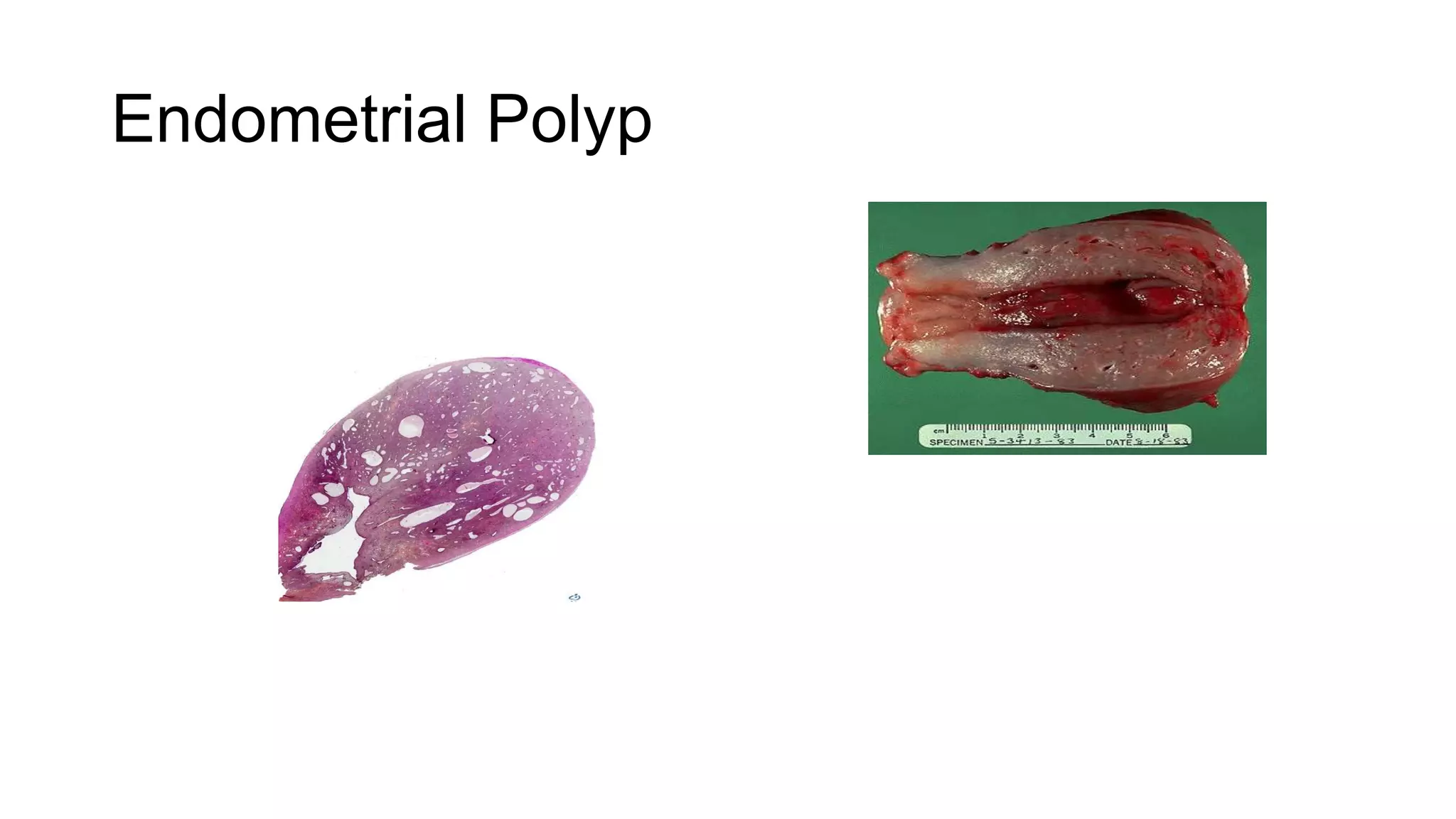 P 9 male and female genital tract disorders | PPTX