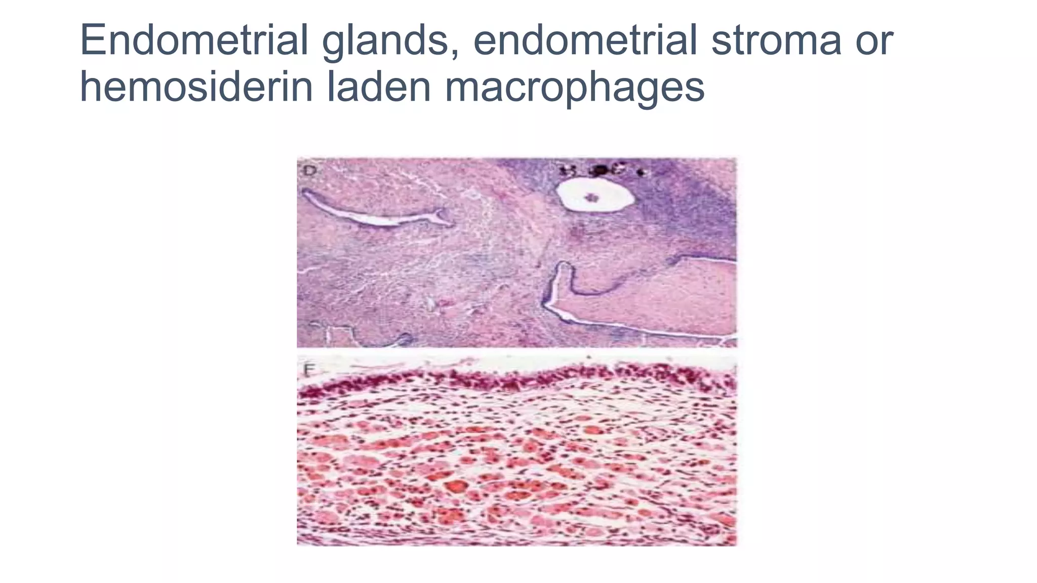 P 9 male and female genital tract disorders | PPTX