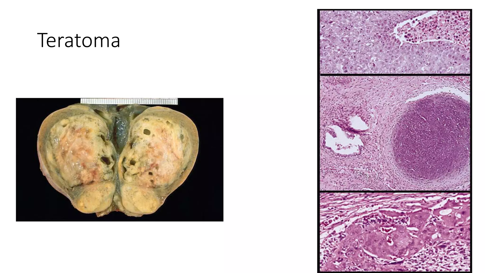 P 9 male and female genital tract disorders | PPTX