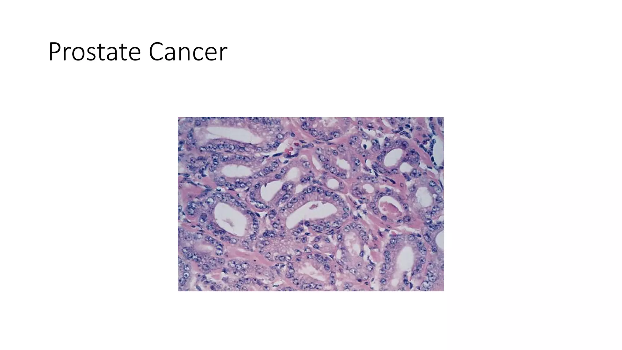 P 9 male and female genital tract disorders | PPTX